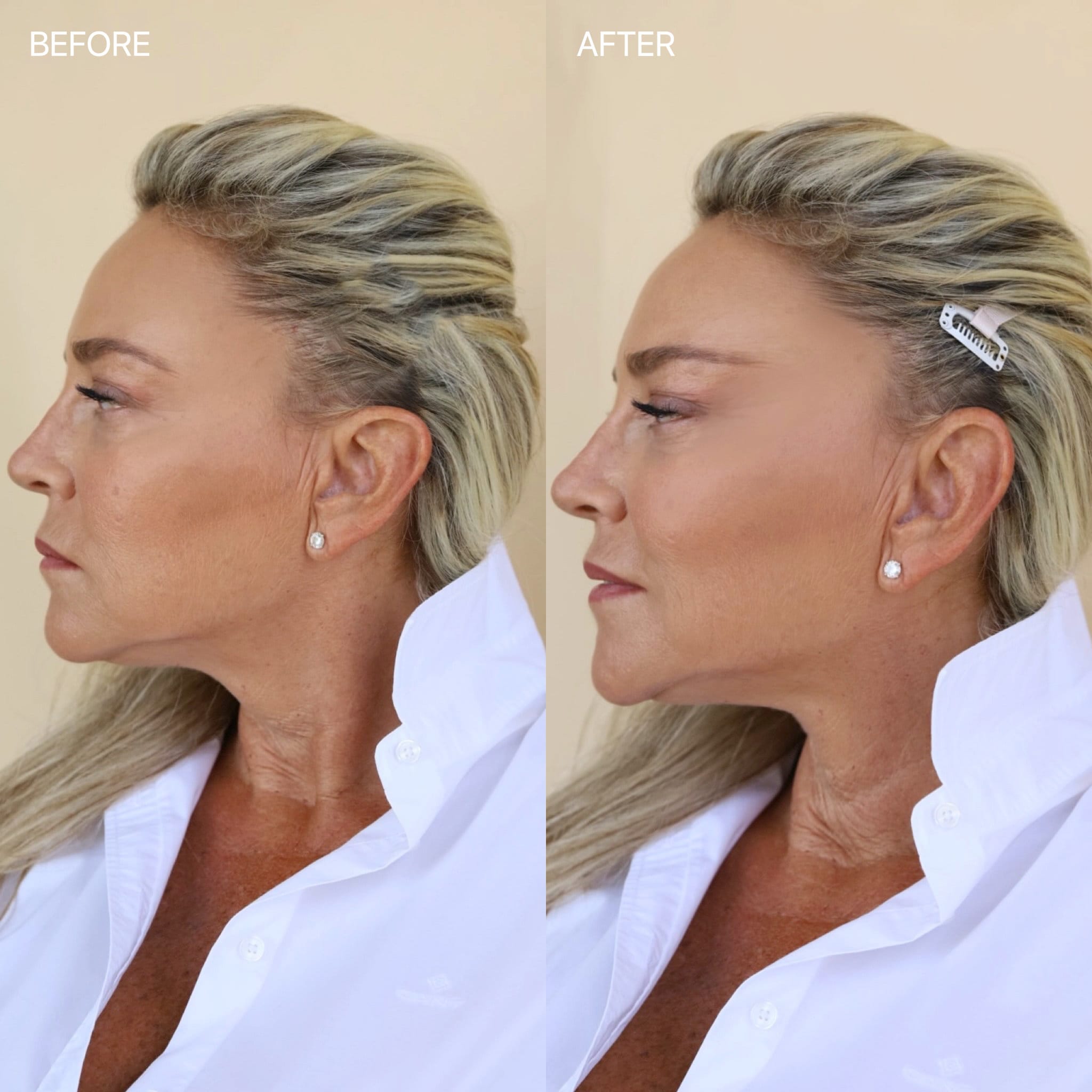 LIFT ME- Natural Eyes LIFT. Get the Fox Eyes Look in 30 Seconds! - for ...