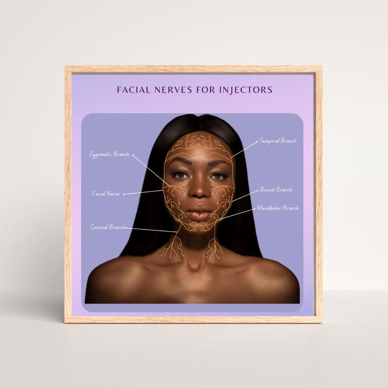 Facial Nerves for Injectors Poster With Labels - Etsy