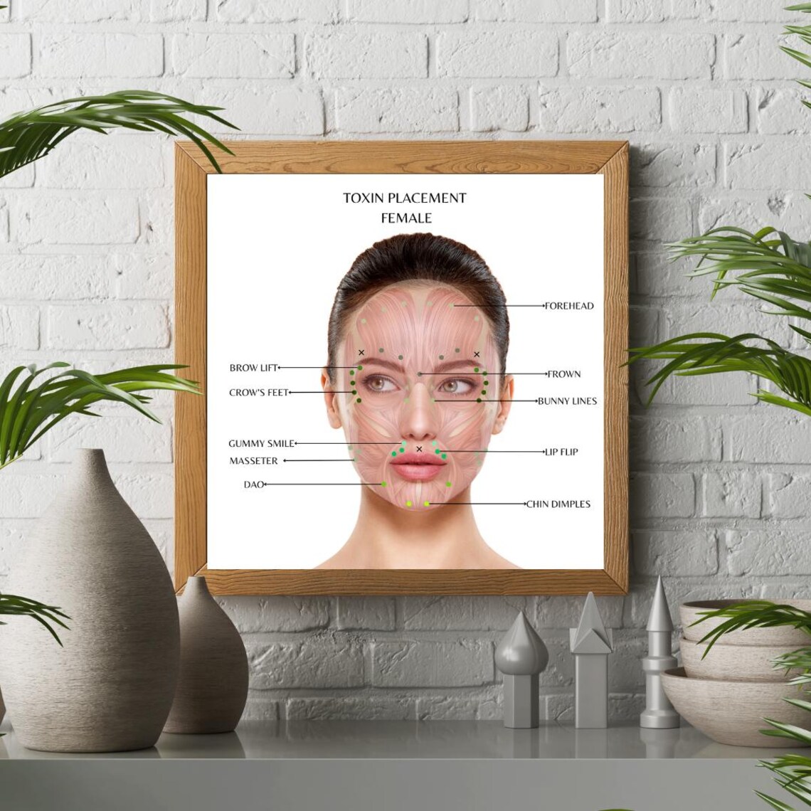 Toxin Injection Placement Chart – Female | Aesthetic Injector Guide ...