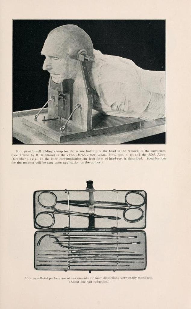 46 Rare Antique Human Autopsy Books on USB - Pathology Post Mortem ...