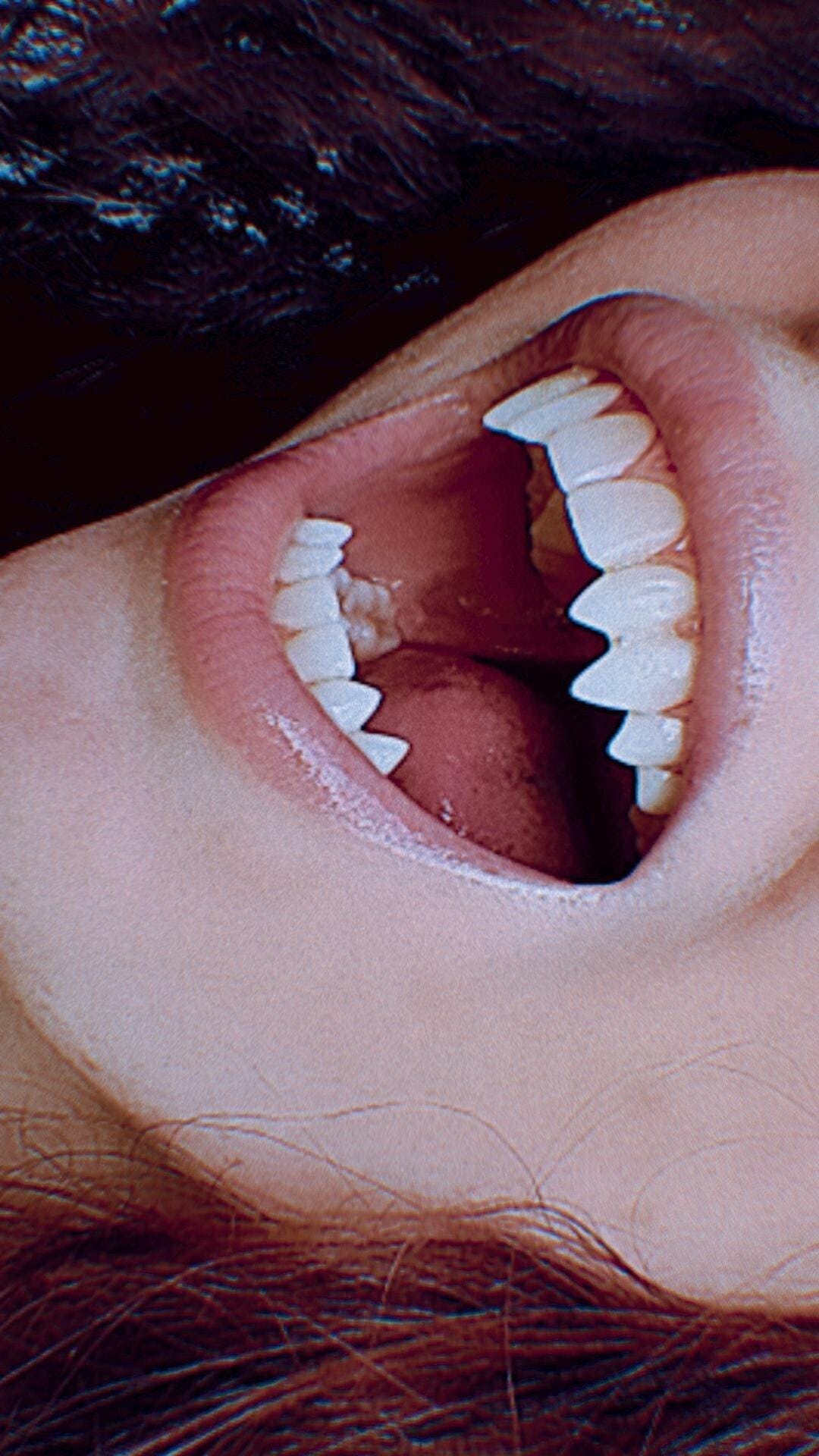 People With Vampire Like Teeth