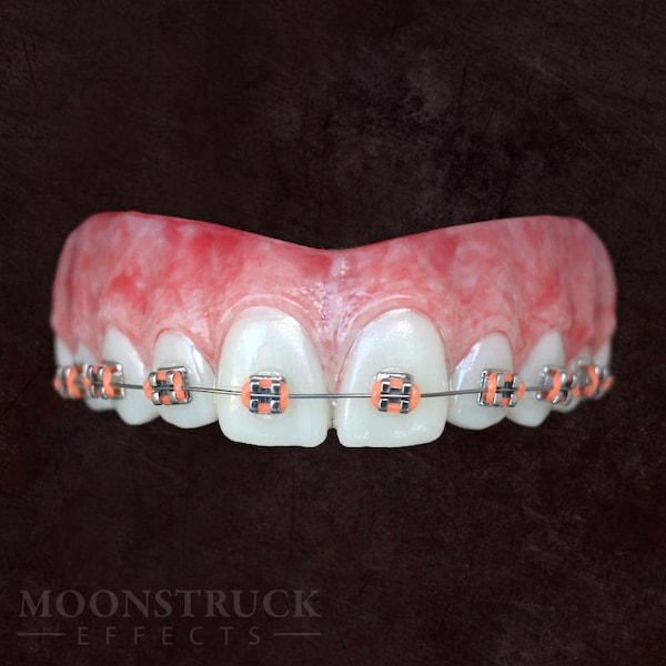 Fake Braces For Teeth Costume Etsy