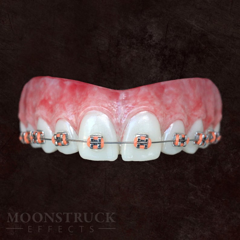 Funny Fake Braces Randow Collor / Geek / Ugly Betty / Nerd / Teenager ...
