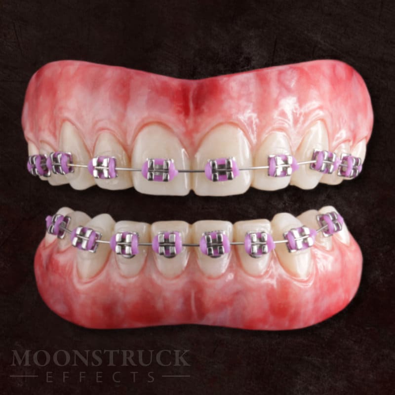 Natural Fake Braces Random Color / Geek / Nerdy / Ugly Betty ...