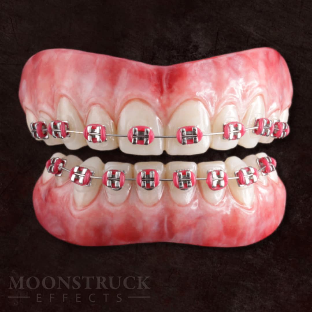 Natural Fake Braces - Random Color / Geek / Nerdy / Ugly Betty ...