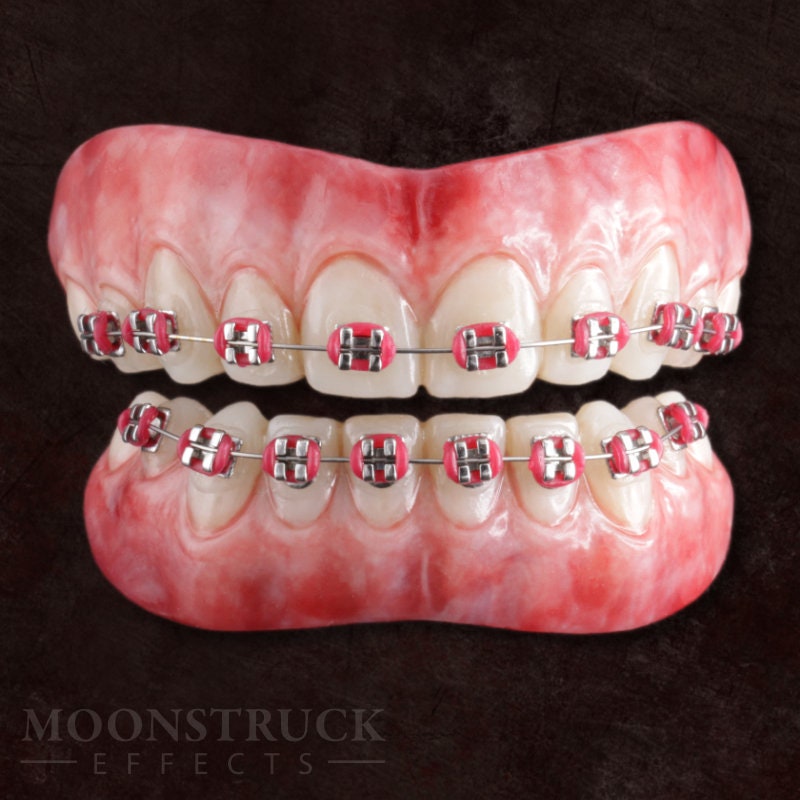 Fake Braces - Etsy