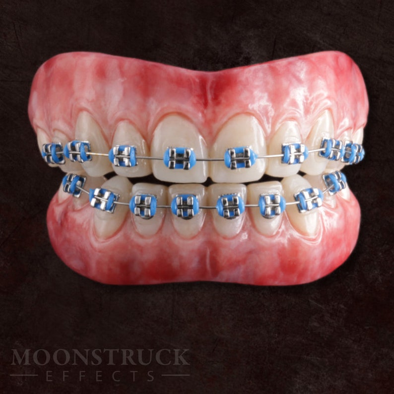 Natural Fake Braces Random Color / Geek / Nerdy / Ugly Betty ...