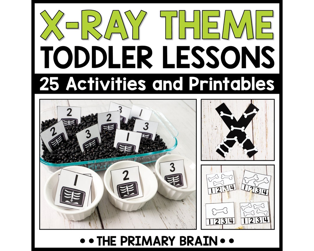 Letter X Toddler Activities | Tot School Lesson Plans | Homeschool ...