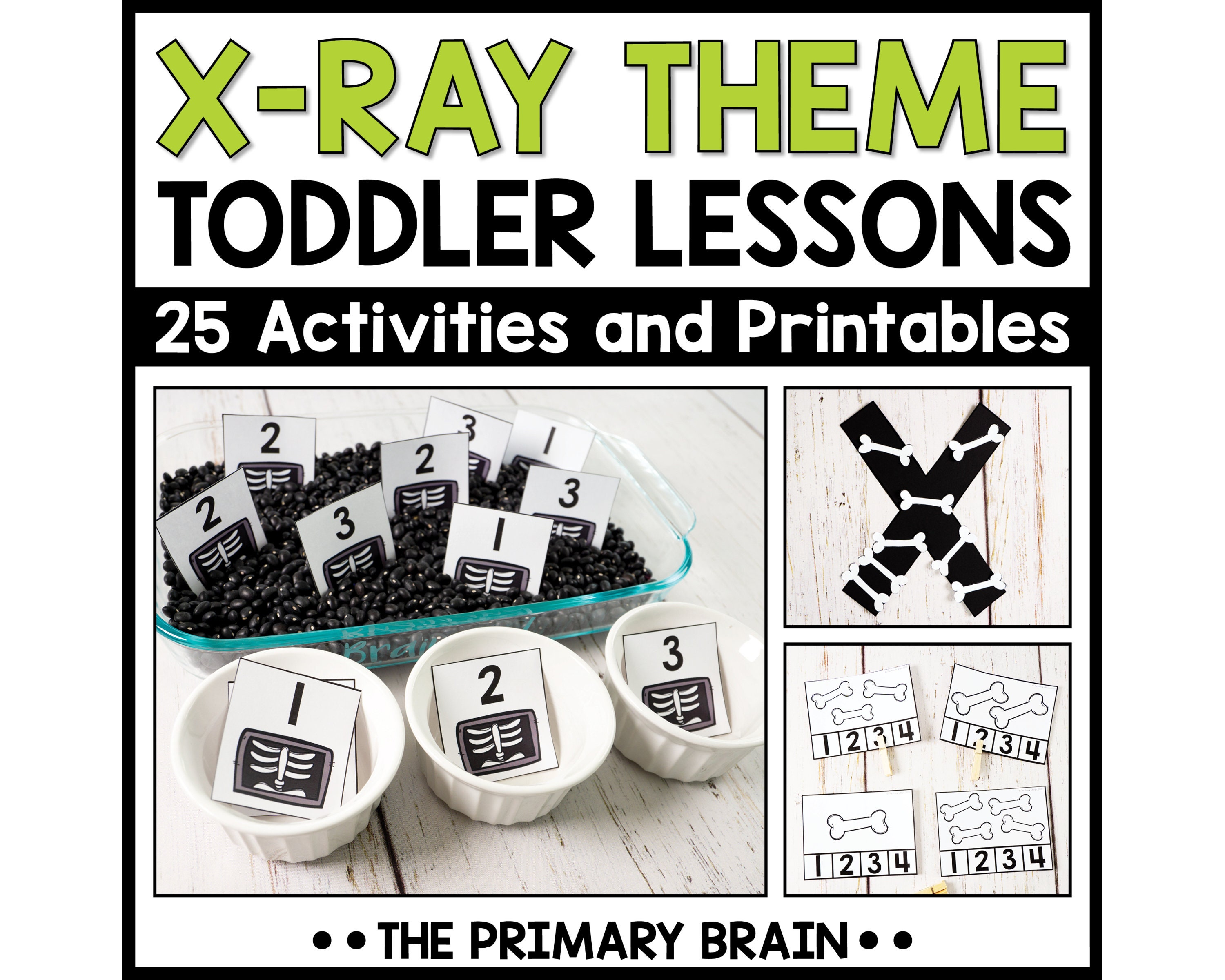 Letter X Toddler Activities | Tot School Lesson Plans | Homeschool ...