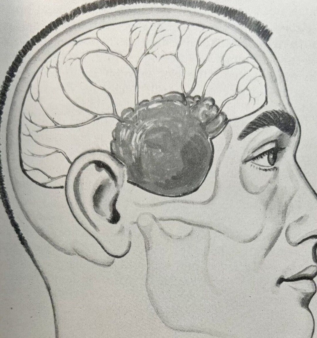 1963 Acute Head Injury Medical Reference 2nd Edition Evans C Thomas ...