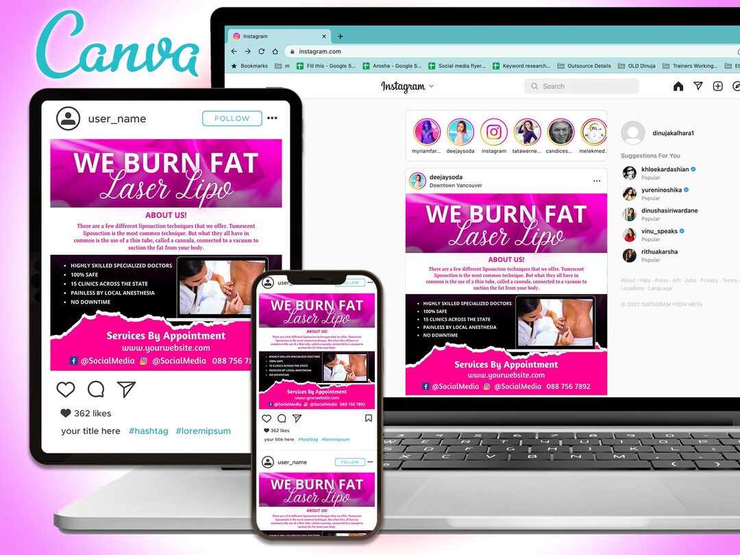 Laser Lipo Flyer Canva Template for DIY Social Media Marketing. - Etsy