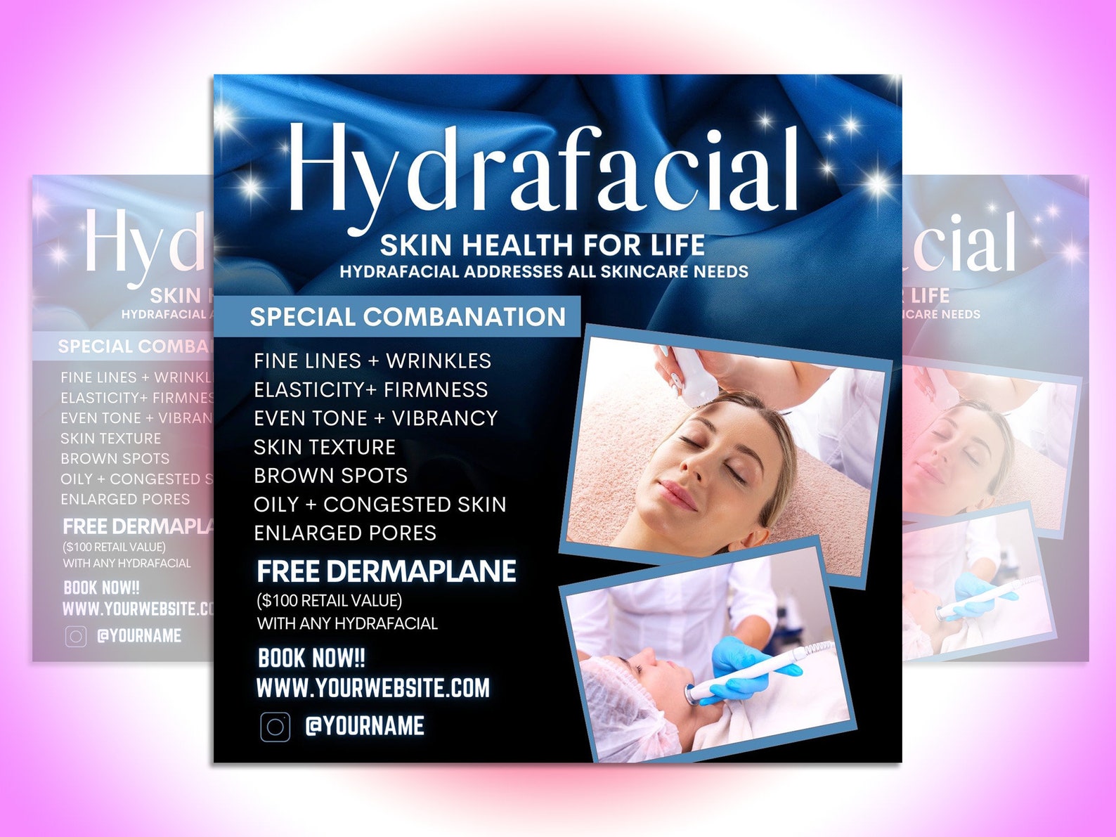 Hydrafacial Flyer Canva Template for DIY Social Media Marketing. - Etsy