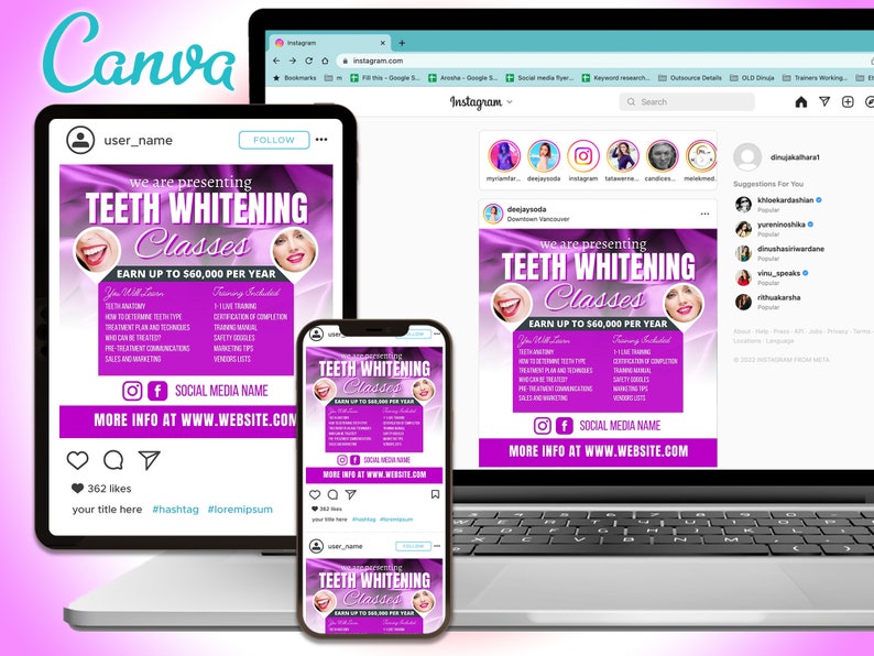 Teeth Whitening Training Flyer Canva Template for DIY Social Media Marketing. - Etsy