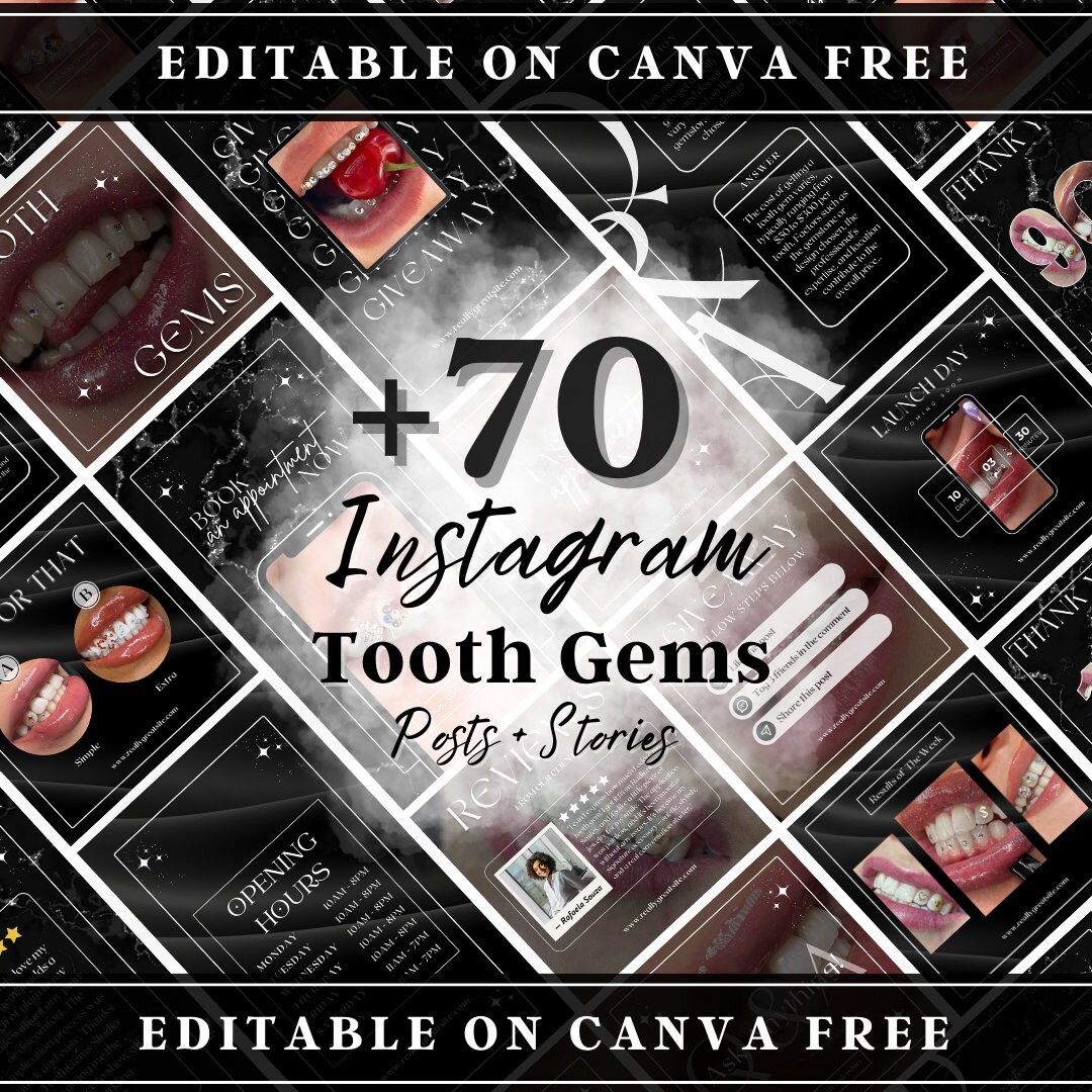 Luxury Tooth Gem Instagram Templates, Editable Black Story Posts ...