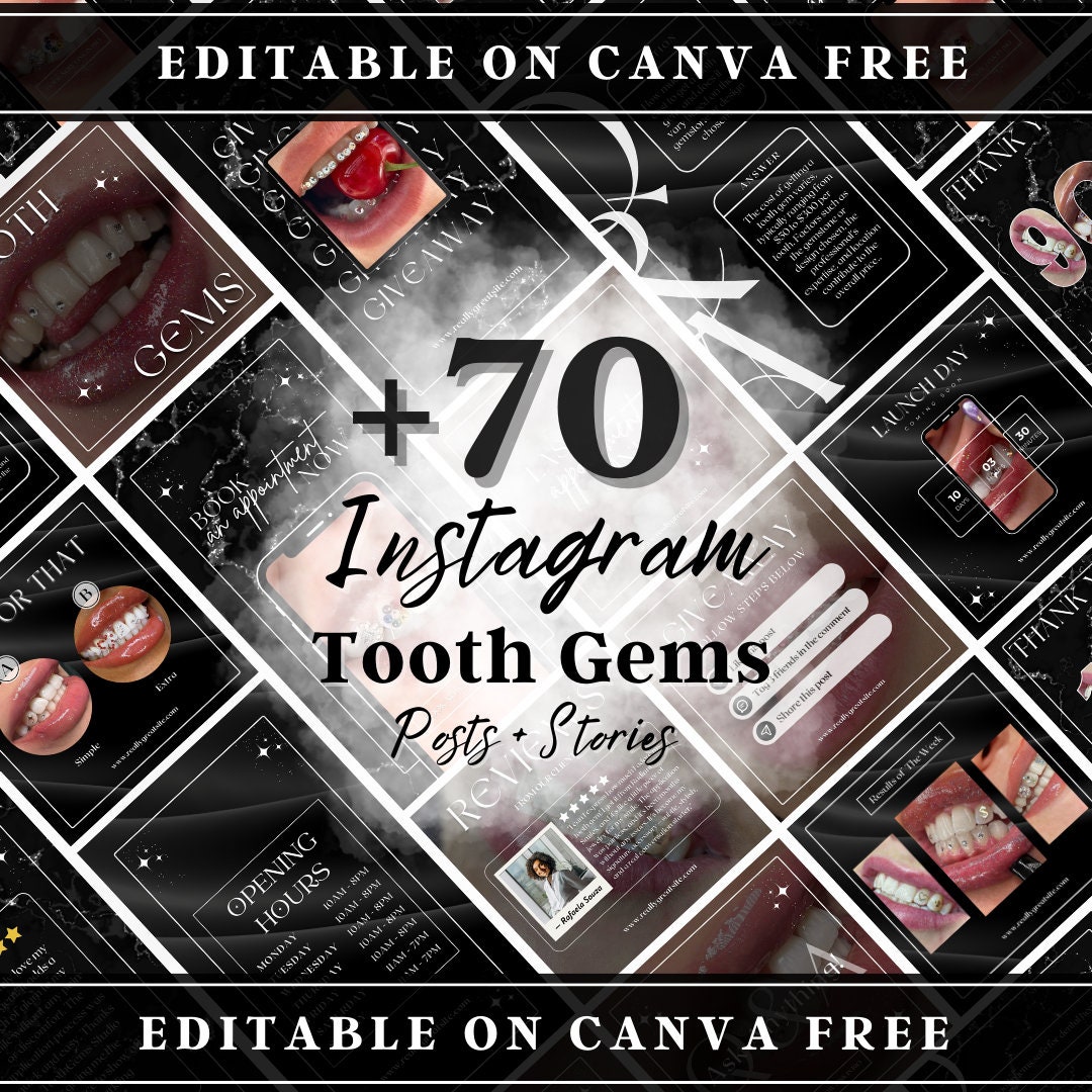 Luxury Tooth Gem Instagram Templates, Tooth Gem Instagram Posts, Black ...