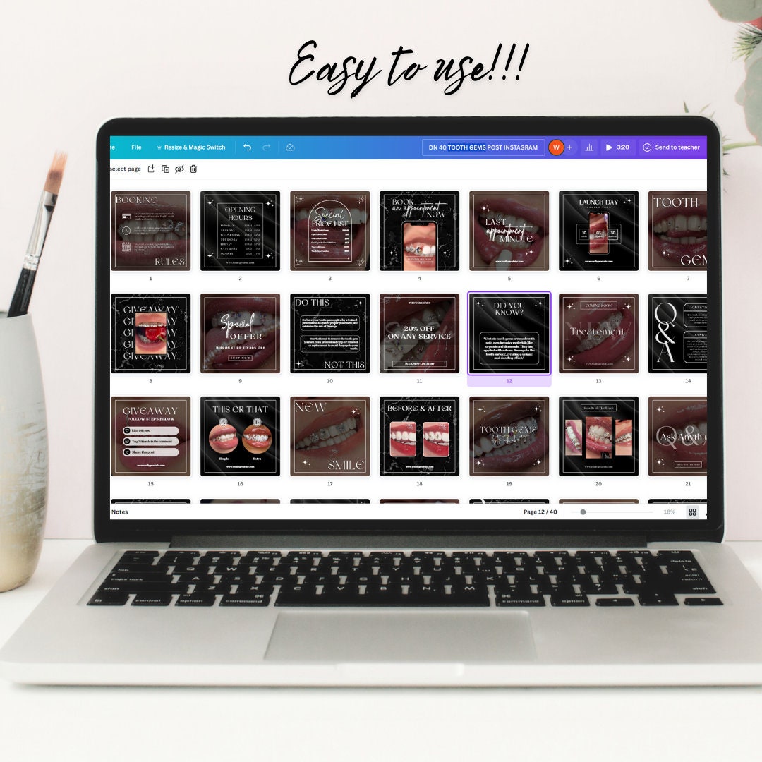 Luxury Tooth Gem Instagram Templates, Editable Black Story Posts ...