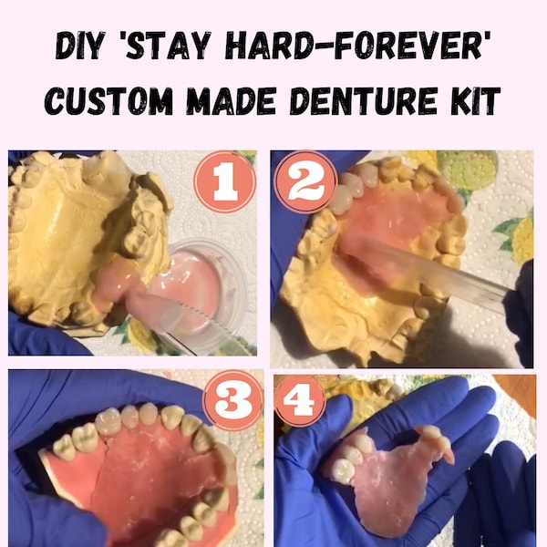 Partial Dentures - Etsy