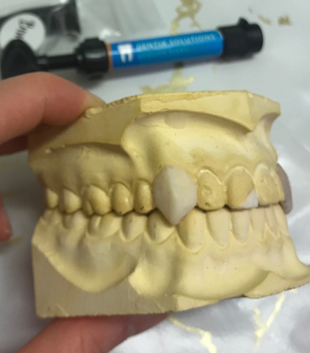 DIY Custom Fangs Vampire Veneers Grillz Canine/eye Tooth Removable ...