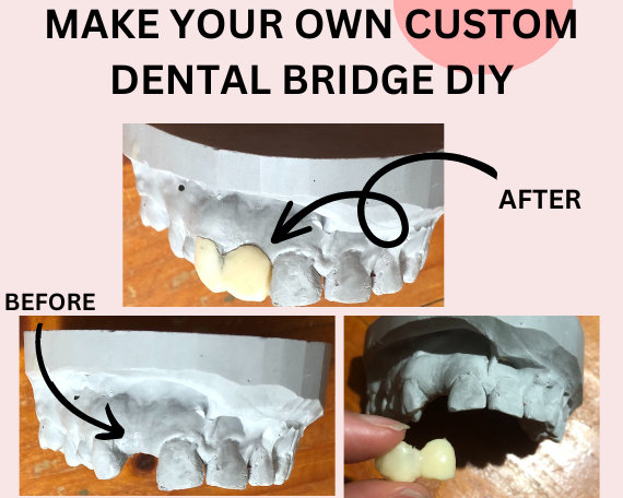 Make Your Own False Teeth Kit