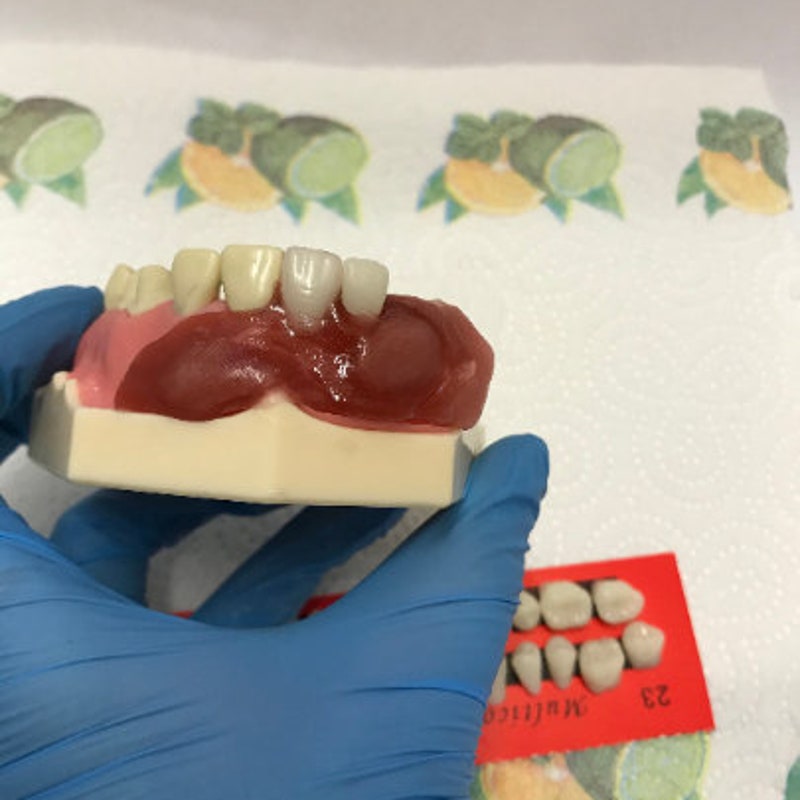 Kit de dentadura postiza - Etsy México