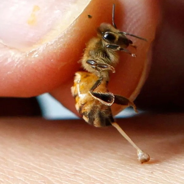 Bee Venom Cream - Etsy