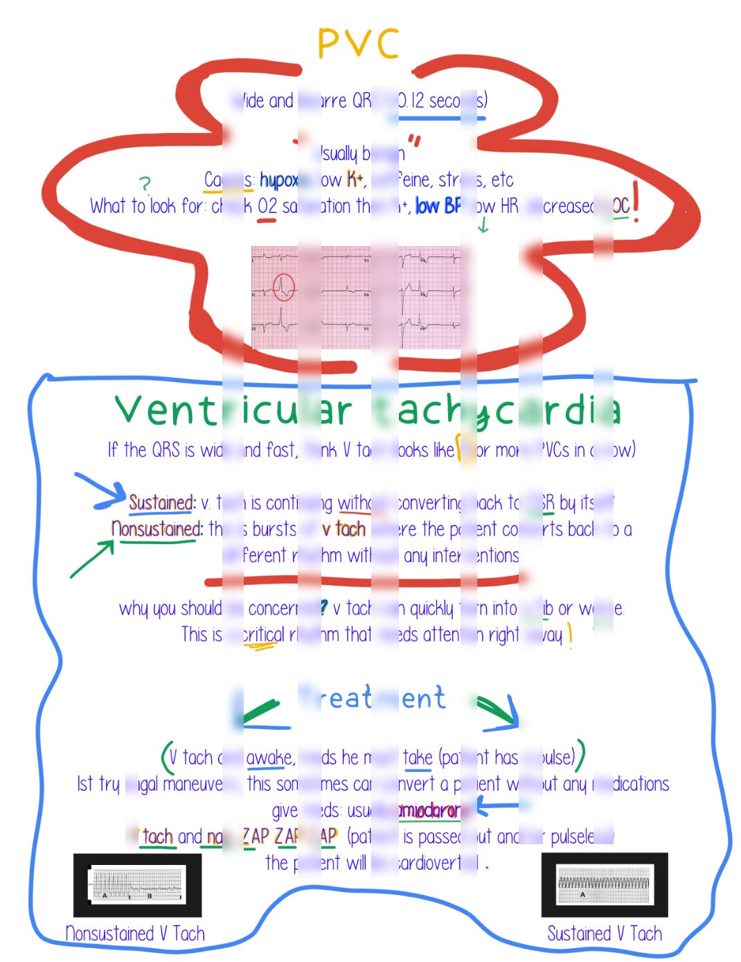 NCLEX EKG Bundle - 7 Handwritten Study Sheets - Cheat Sheets - High ...