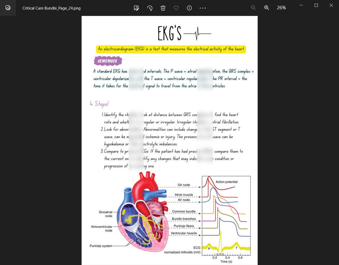 NCLEX EKG - Handwritten Study Sheet - What You Must Know for NCLEX 2026 ...