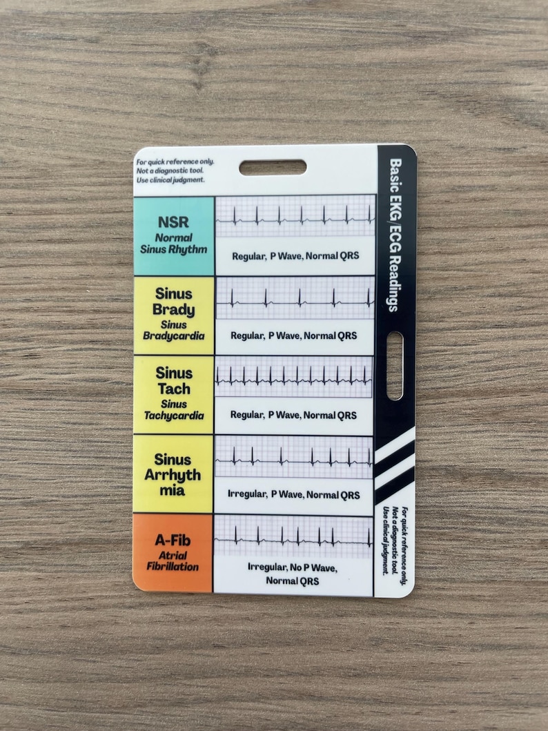 ECG/EKG Rhythms Badge Buddy | EKG Badge Card | Cardiac Nurse Badge Card ...