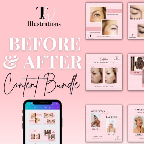 7 Before and After Instagram Templates Beauty Instagram | Etsy
