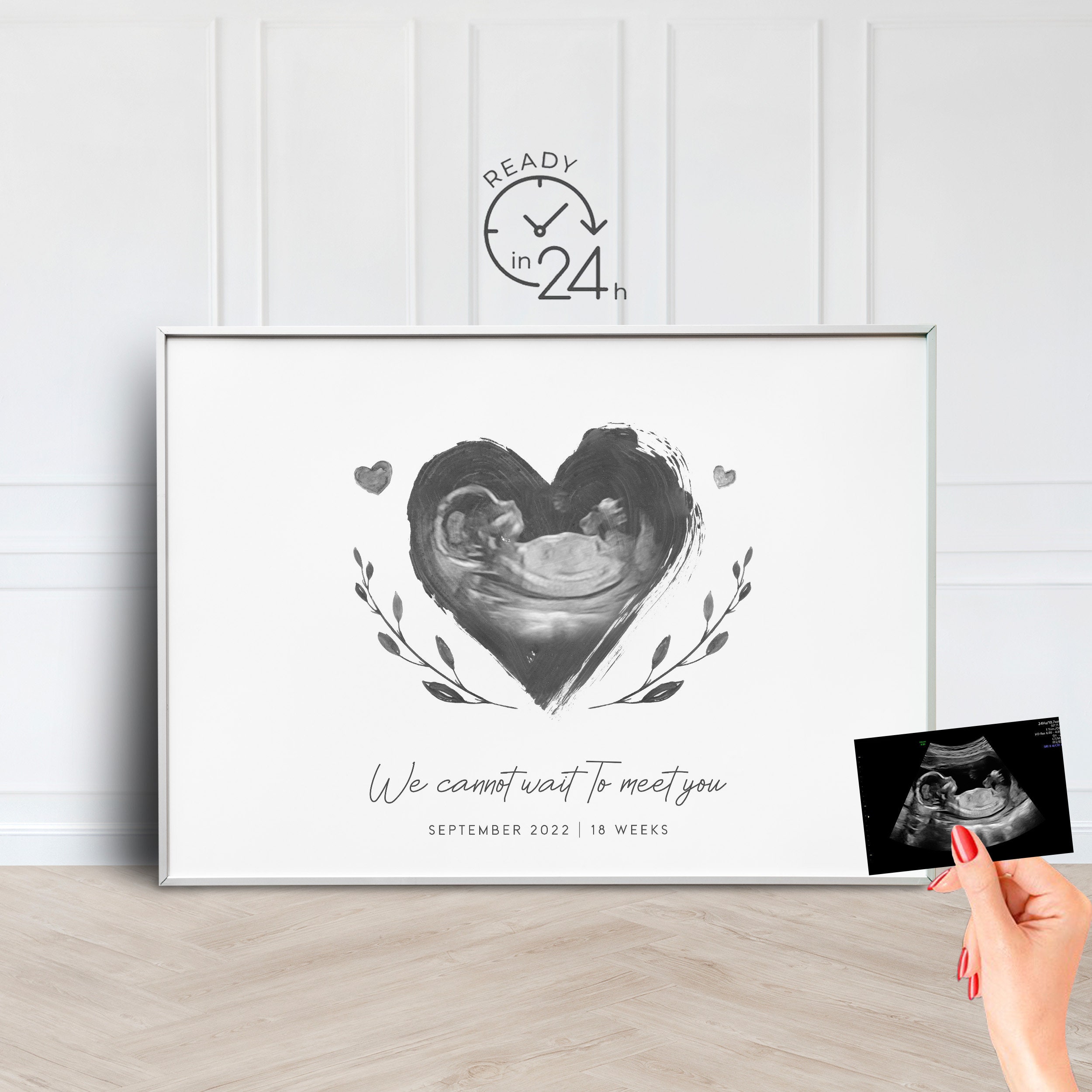 Custom Baby Ultrasound Maternity Nursery Decor Baby Room Decor - Etsy