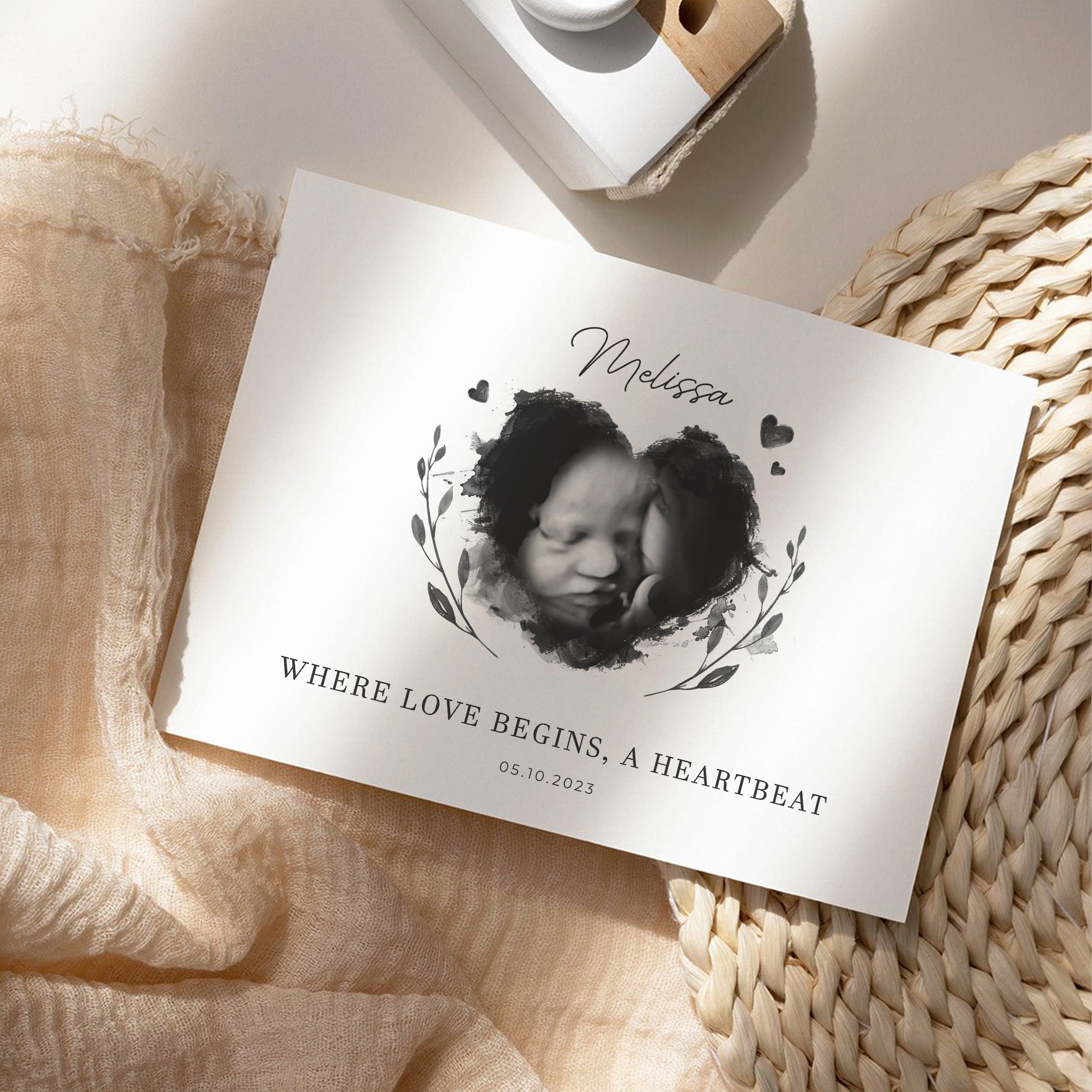 Watercolour Baby Scan Ultrasound Print Shower Gift for Mum to Be ...