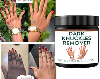 Dark Knuckle Serum - Etsy