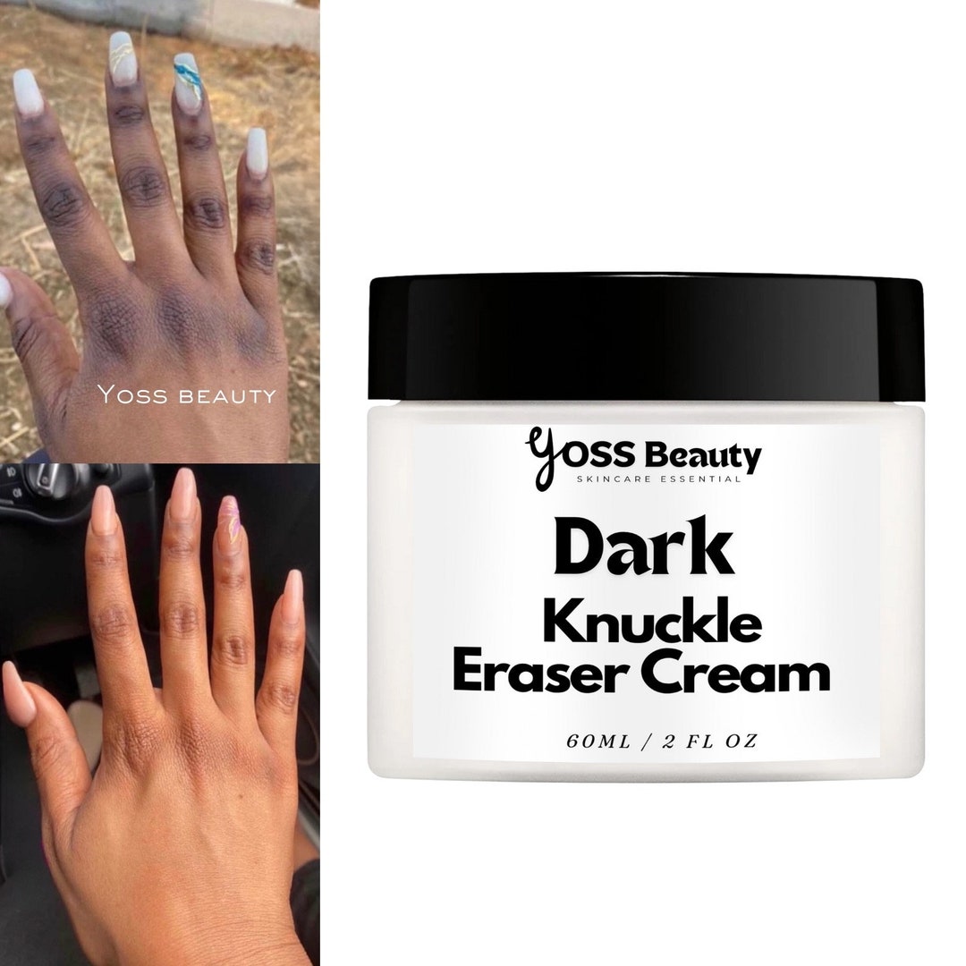 Dark Knuckles Cream, Extra Strong Knuckle Cream, Even and Glowing Skin ...