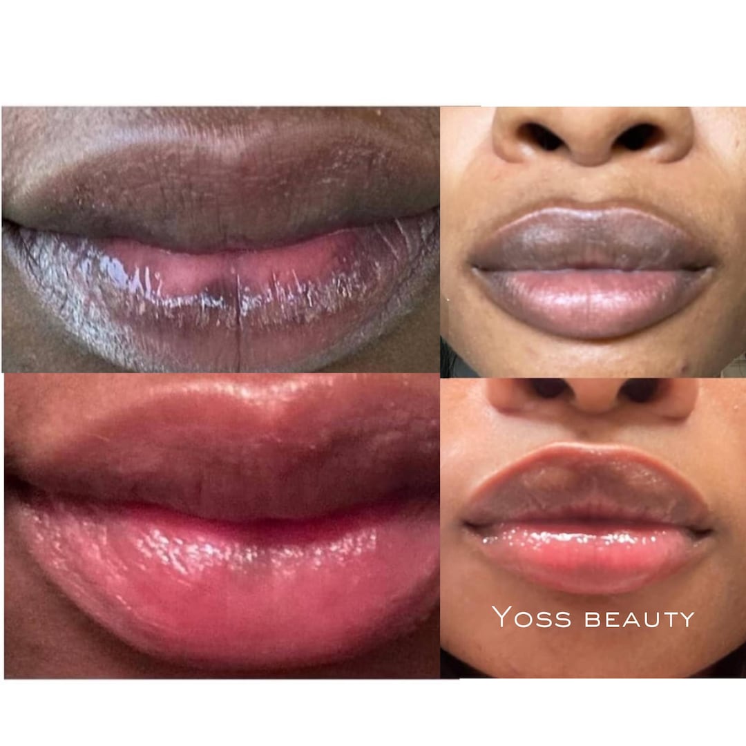 Lip Brightening Cream, Pink Lips Cream, Glow Lip Cream - Etsy Australia