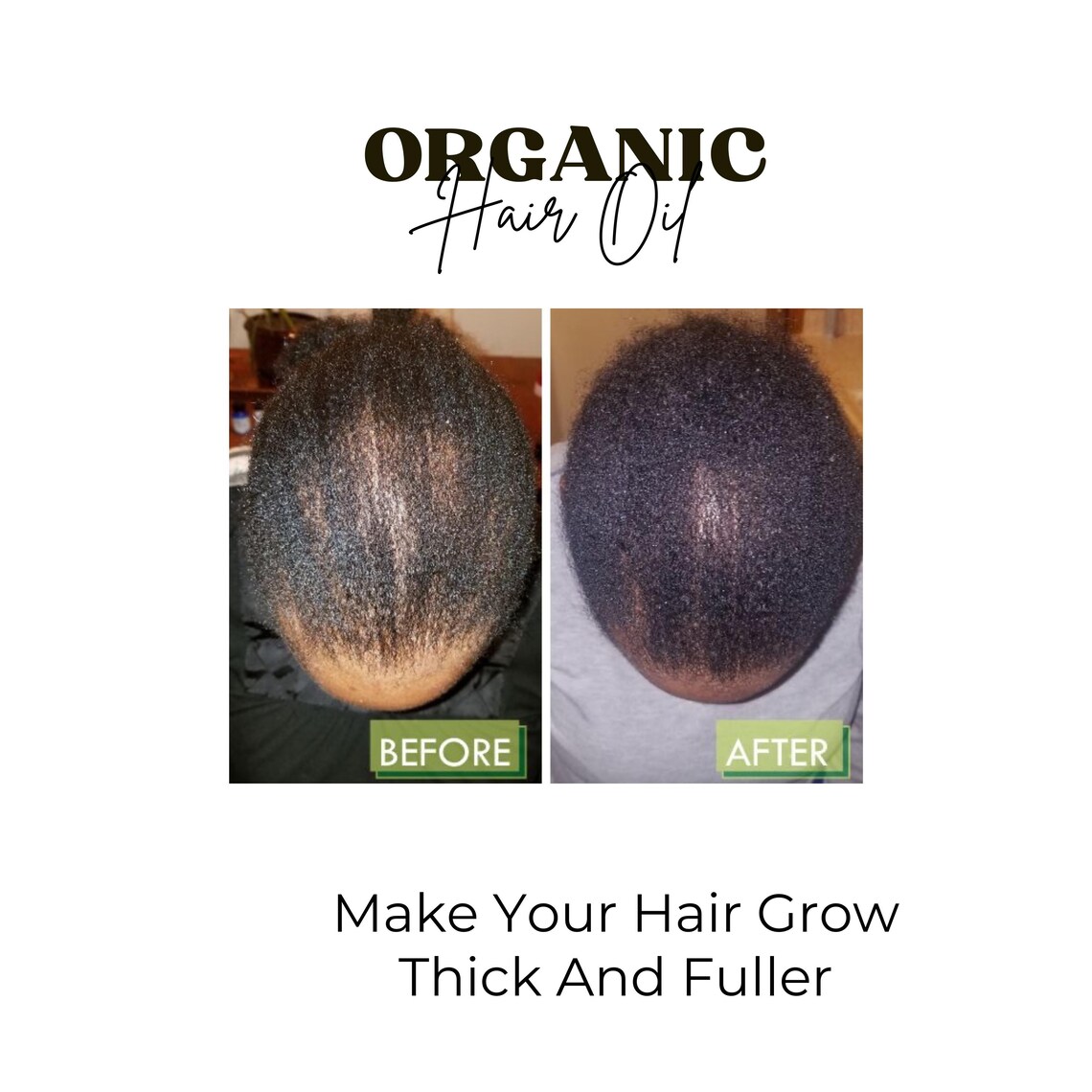 Fast Hair Growth Oil, Extra Strength Hair Oil, Thicker, Stronger Hair ...