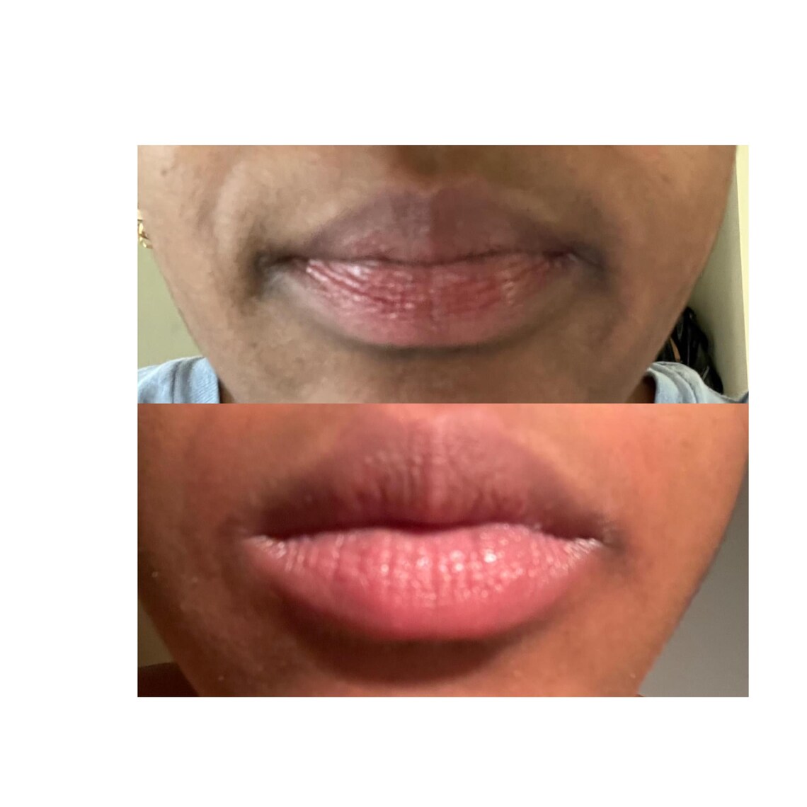 Lip Brightening Cream, Pink Lips Cream, Glow Lip Cream - Etsy UK