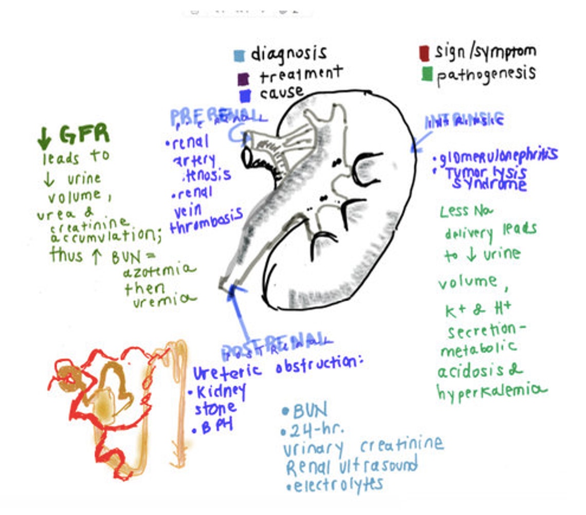 Nursing Notes: Kidney Failure Perfect for Med/surg, Pathophysiology, RN ...