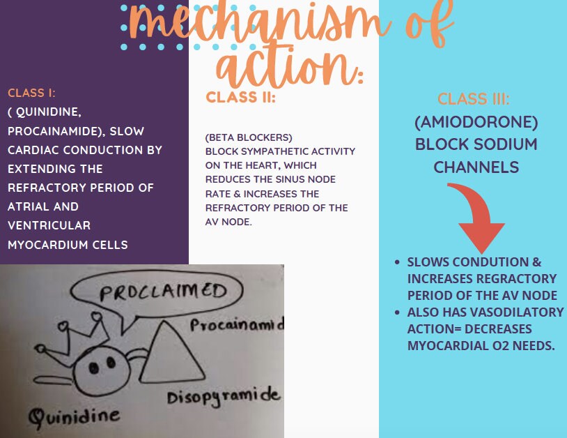 Nurse Practitioner Study Guide: Pharmacology- Antiarrythmic Drugs ...