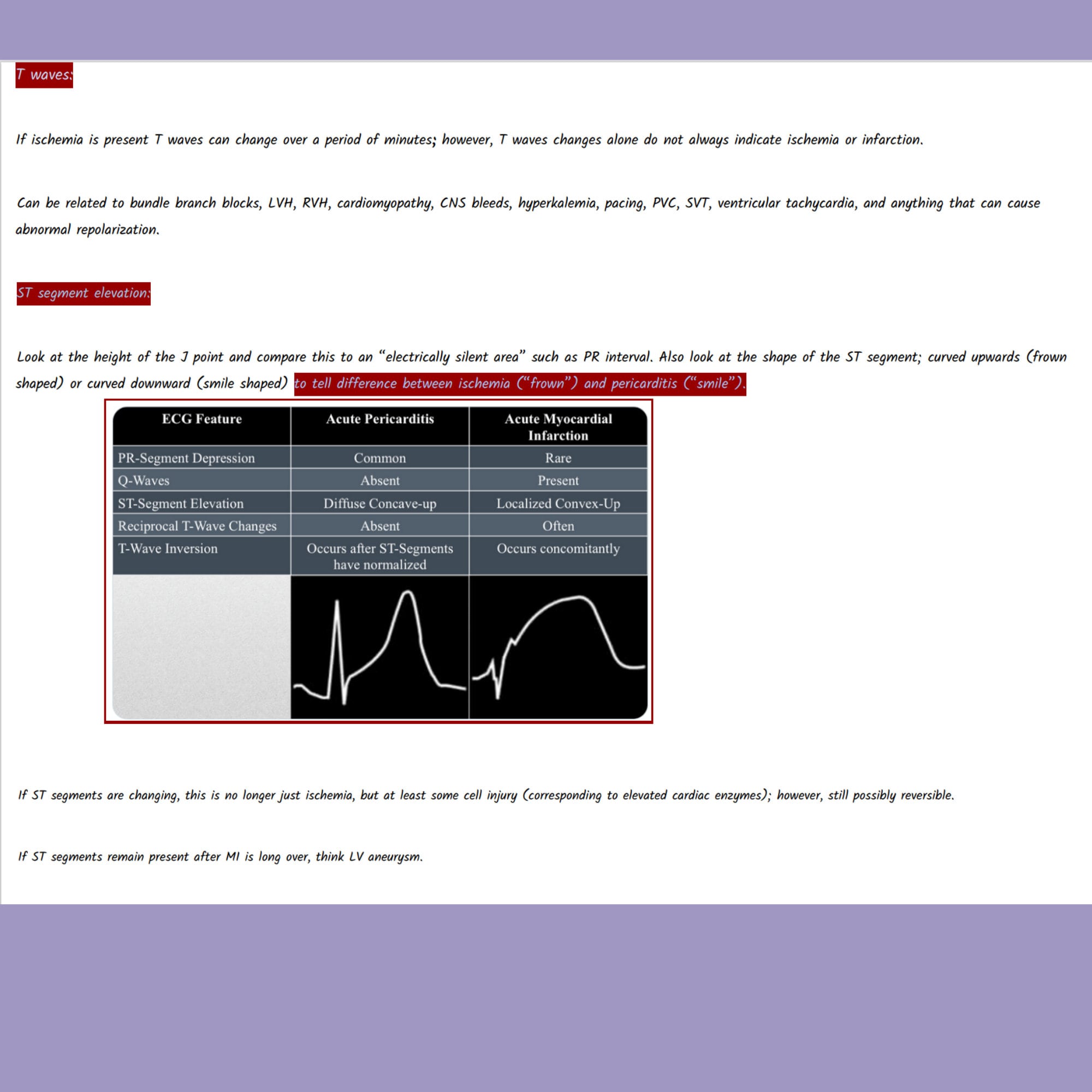 EKG Study Guide for Ischemia Nurse Practitioner Physician Assistant ...