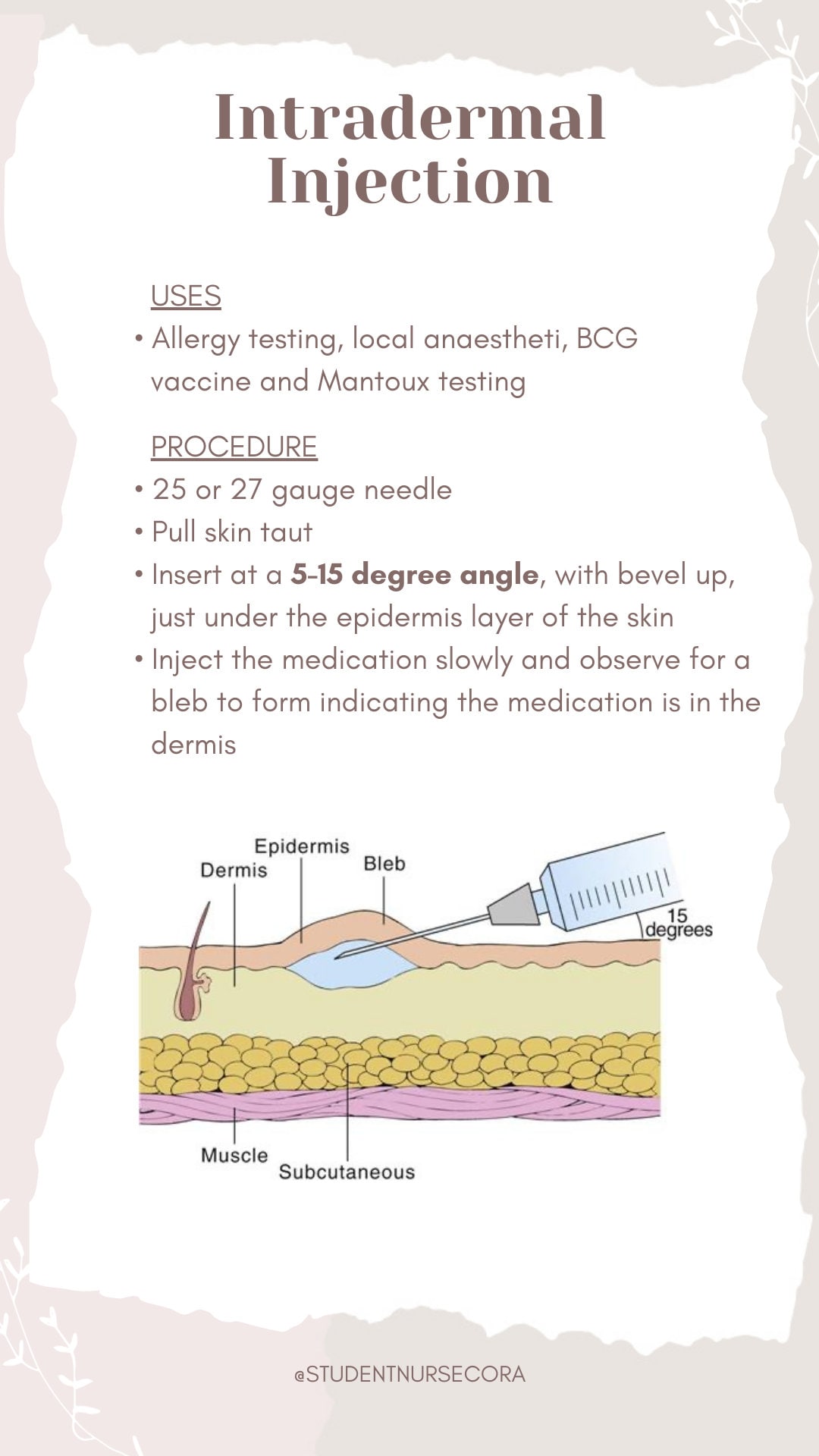 Bleb Intradermal Injection