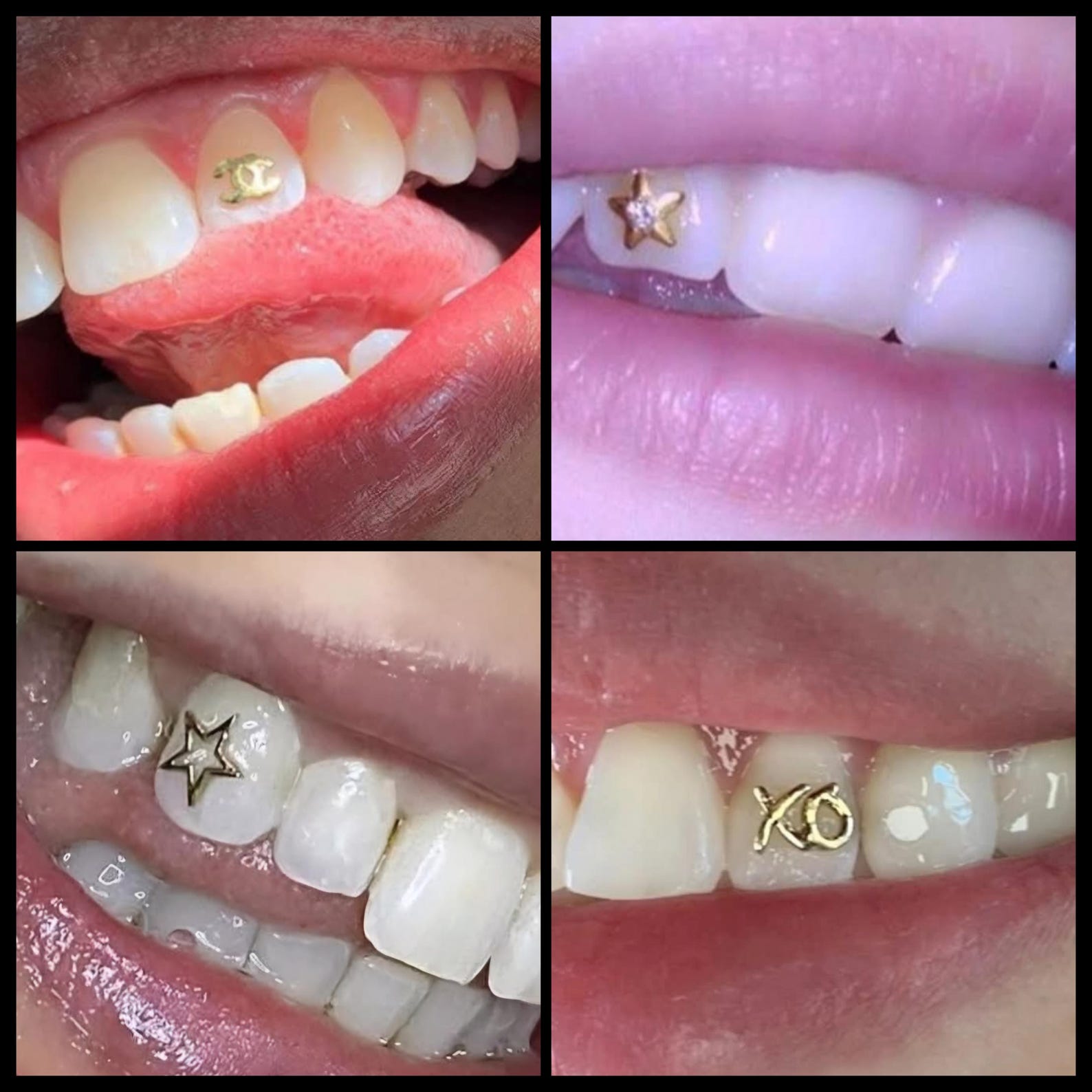 Real 18kt Solid Gold Tooth Jewelry | Tooth Bling | Tooth Gems - Etsy