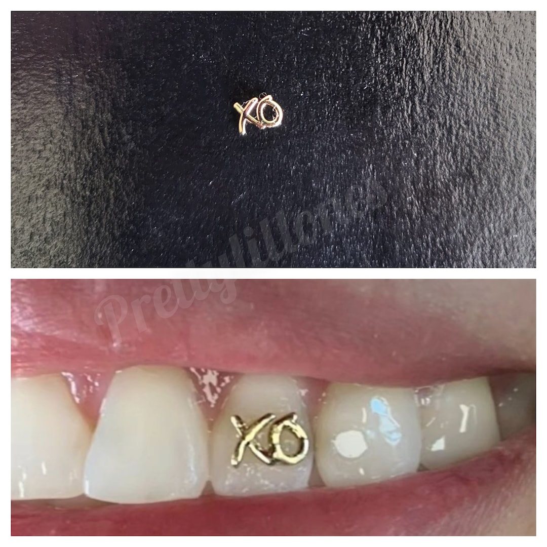 Real 18kt Solid Gold Tooth Jewelry Tooth Bling - Etsy