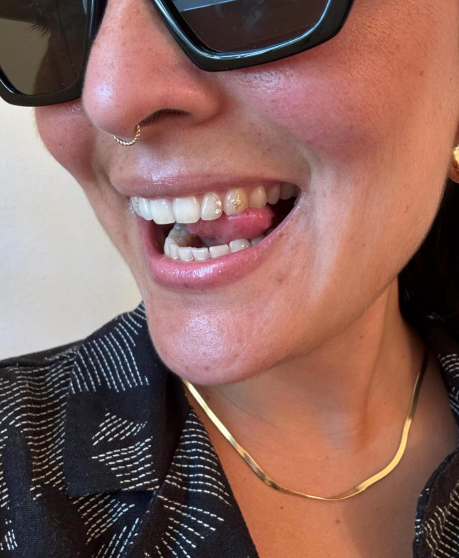 Real 18kt Solid Gold Tooth Jewelry | Tooth Bling | Tooth Gems - Etsy