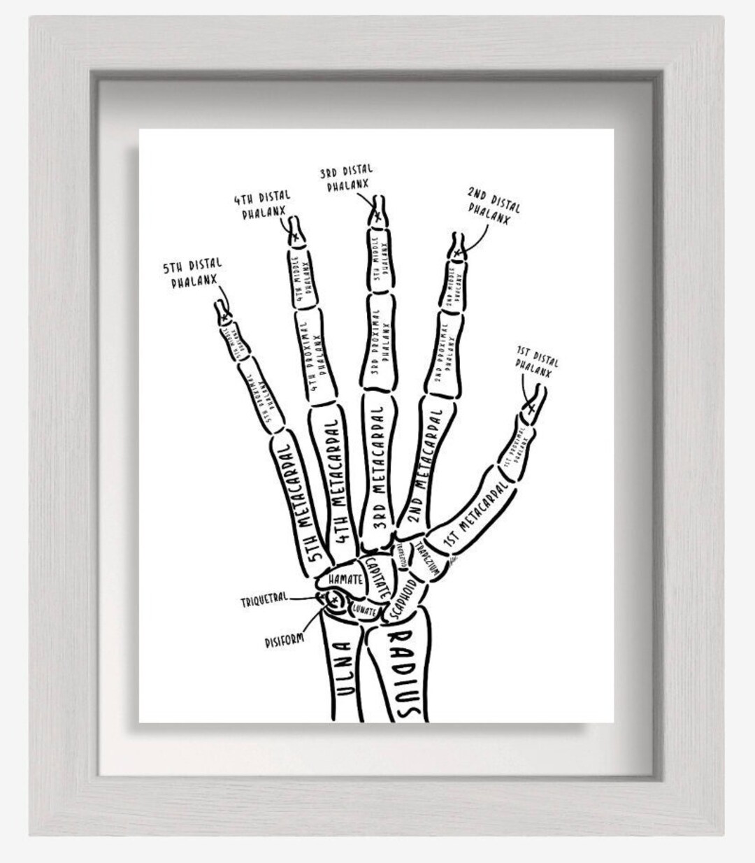 Hand Anatomy Wall Art, Minimalist, Occupational Therapy, Instant ...