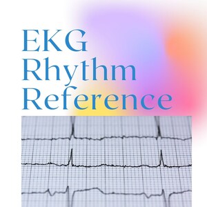 EKG Rhythm Reference - Etsy