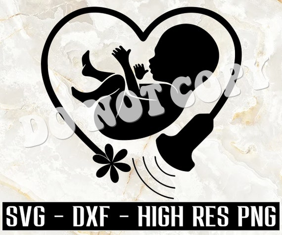 Baby Ultrasound SVG Ultrasound Tech SVG Ultrasound Wand SVG | Etsy