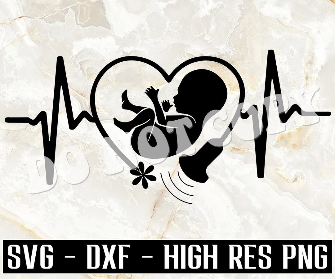 Baby Ultrasound SVG, Ultrasound Tech SVG, Ultrasound Wand SVG, Sonogram ...