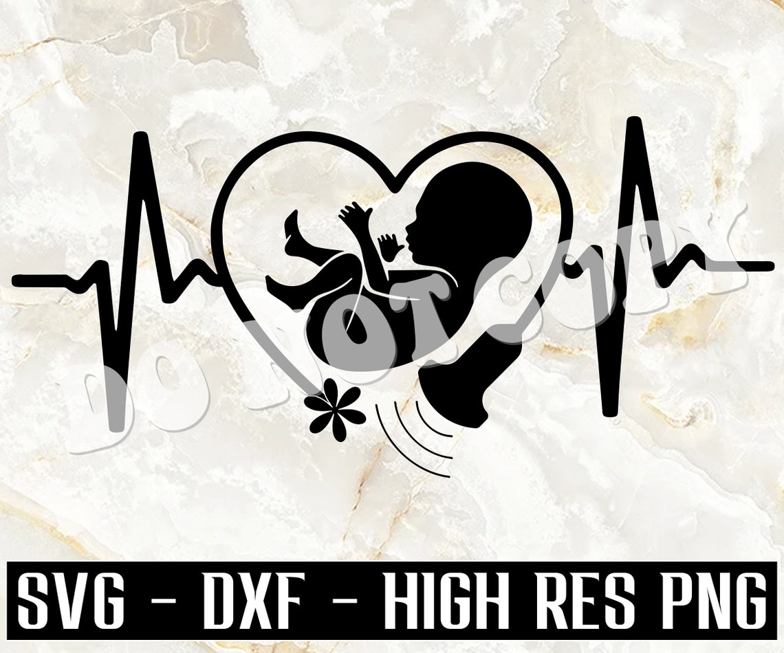 Baby Ultrasound SVG, Ultrasound Tech SVG, Ultrasound Wand SVG, Sonogram ...