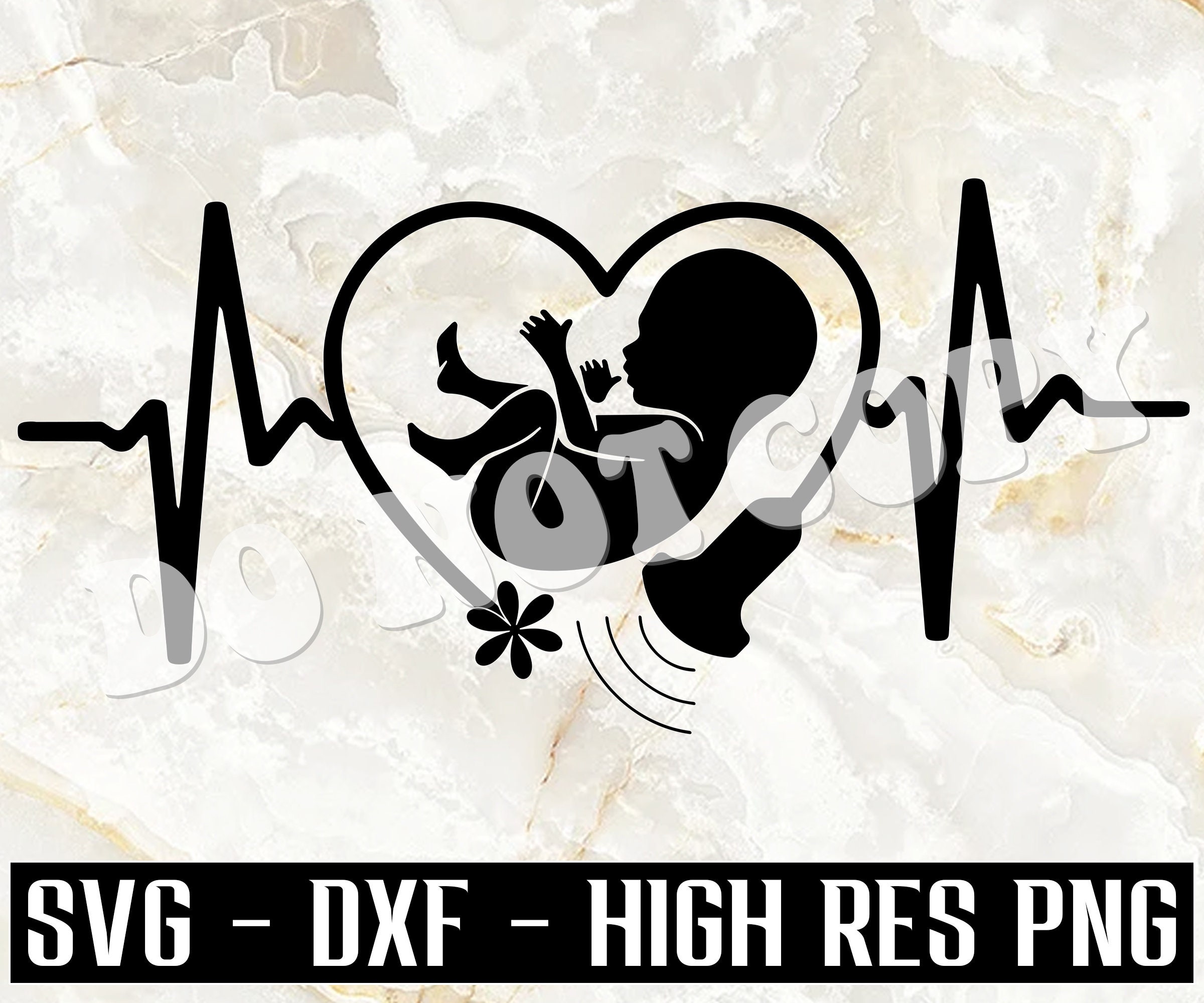 Buy Baby Ultrasound SVG Ultrasound Tech SVG Ultrasound Wand SVG Online ...