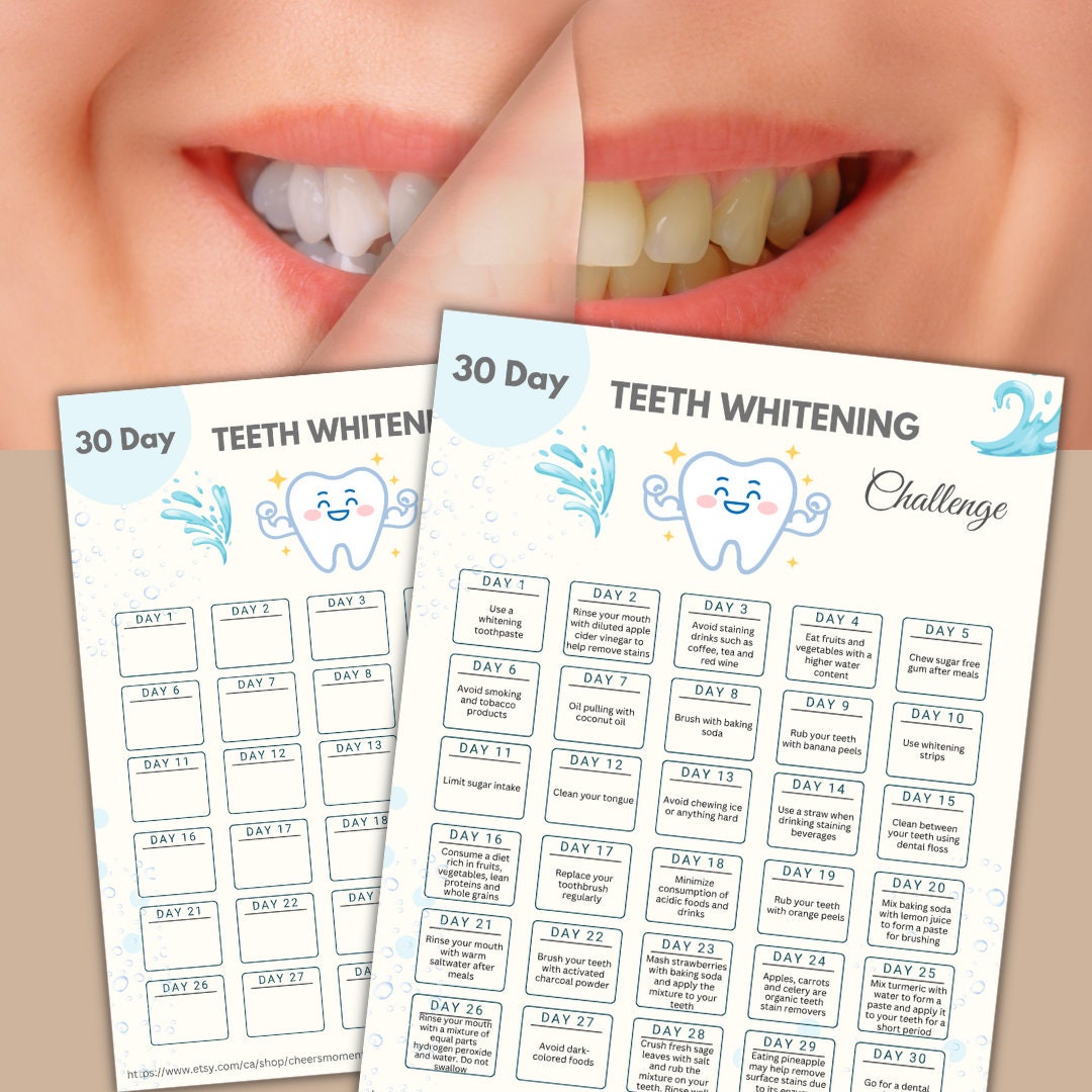30 Day Teeth Whitening Challenge | Teeth Whitening Home Tips | Dental ...